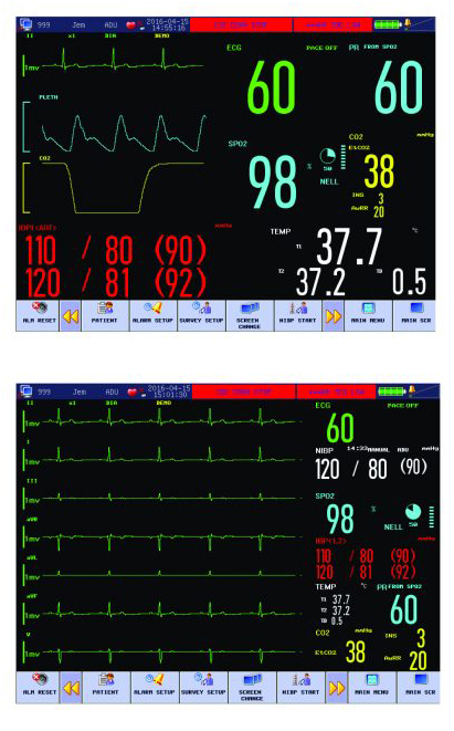 Monitor de cabecera C50 | Spacelabs Healthcare