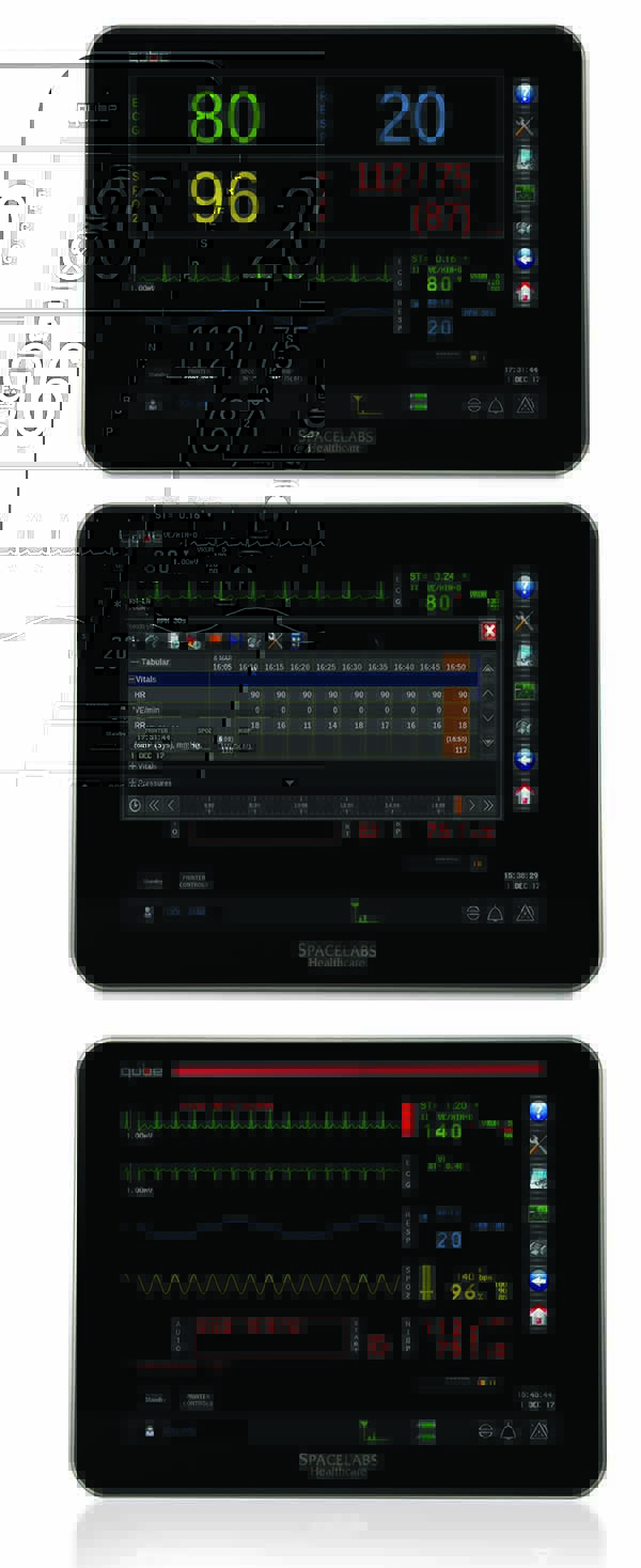 Qube compact bedside monitor - Spacelabs Healthcare